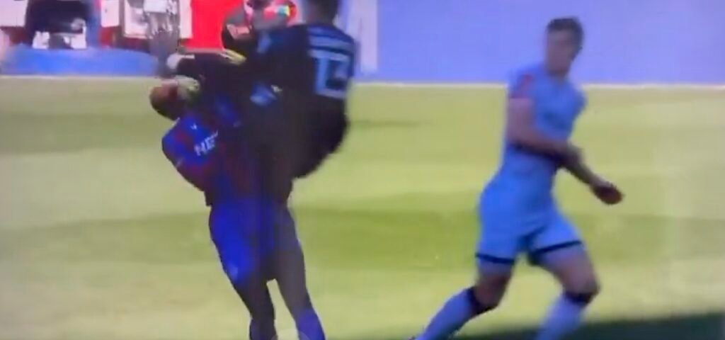 25 Stitches for Mateta After Brutal Collision